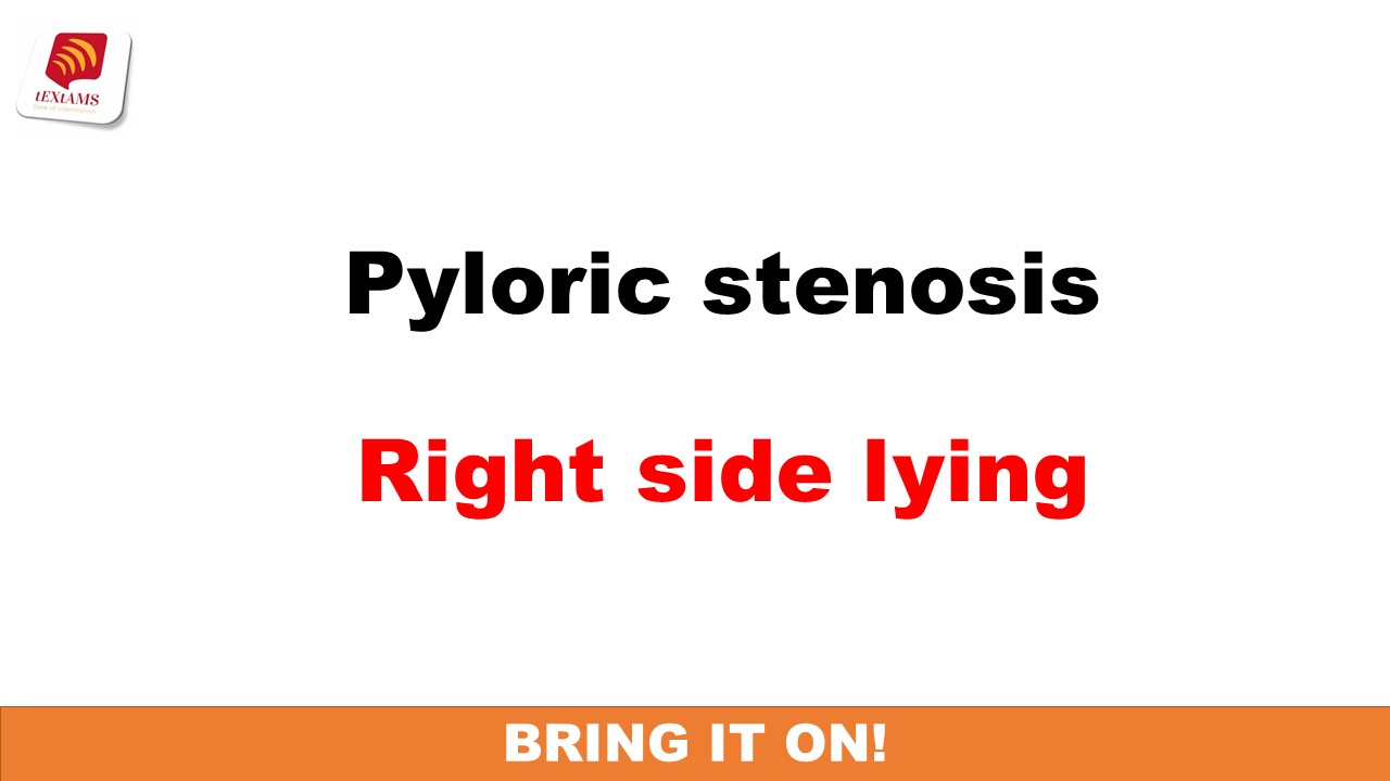 slide27-1 – tEXtAMS